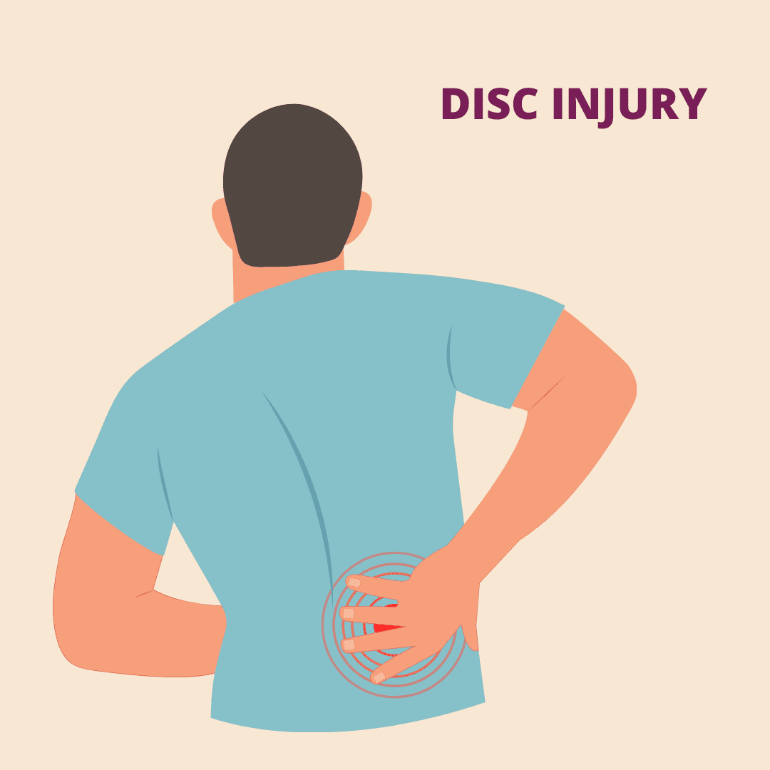 Disc Injury Treatment by Oakland Chiropractor - Riverstone Chiropractic